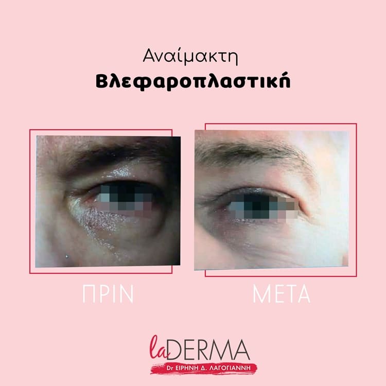 ΔΕΡΜΑΤΟΛΟΓΟΣ ΑΦΡΟΔΙΣΙΟΛΟΓΟΣ ΓΛΥΦΑΔΑ | ΛΑΓΟΓΙΑΝΝΗ ΕΙΡΗΝΗ - Doctors4U.gr